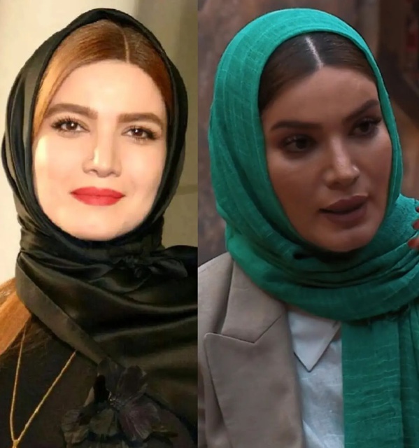 Cosmetic surgeries – gooyadaily